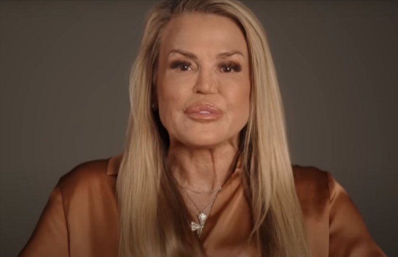 Dominique Brown Plastic Surgery: Everything We Know so Far - Viral ...